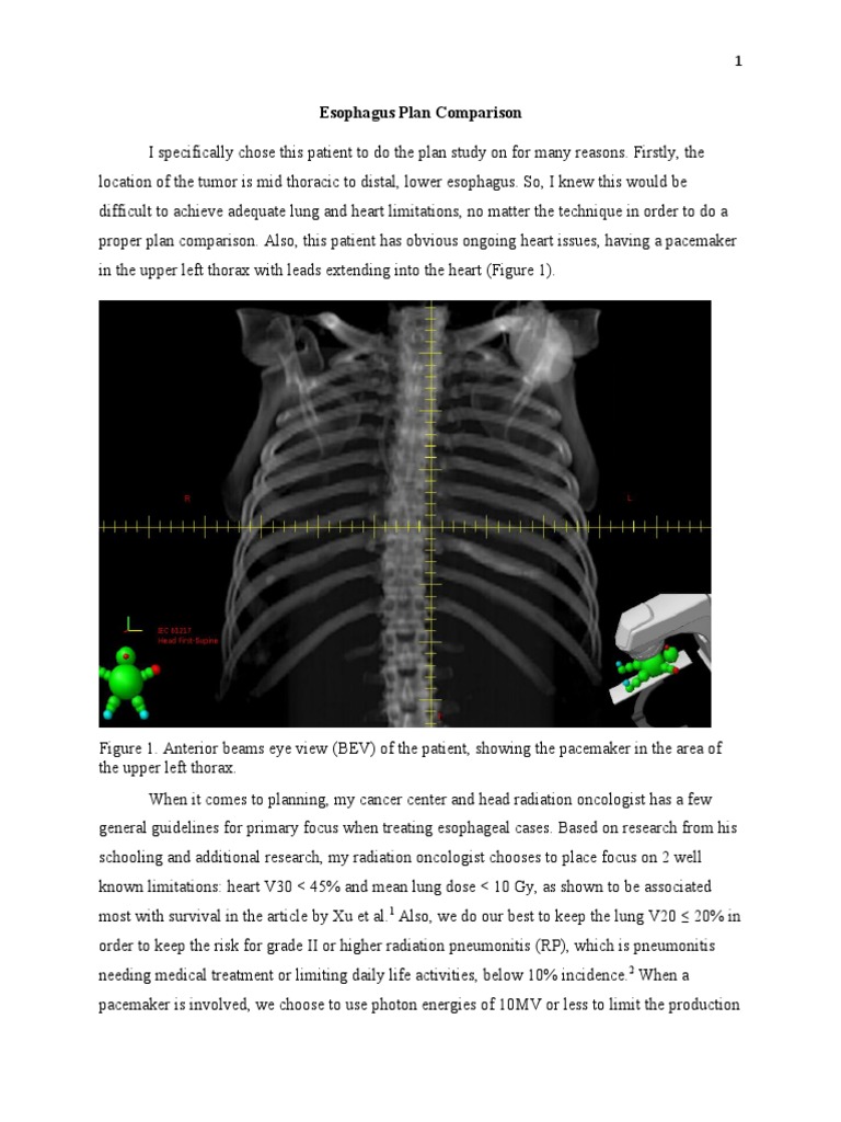 Esoph Study | PDF | Radiation Therapy | Clinical Medicine