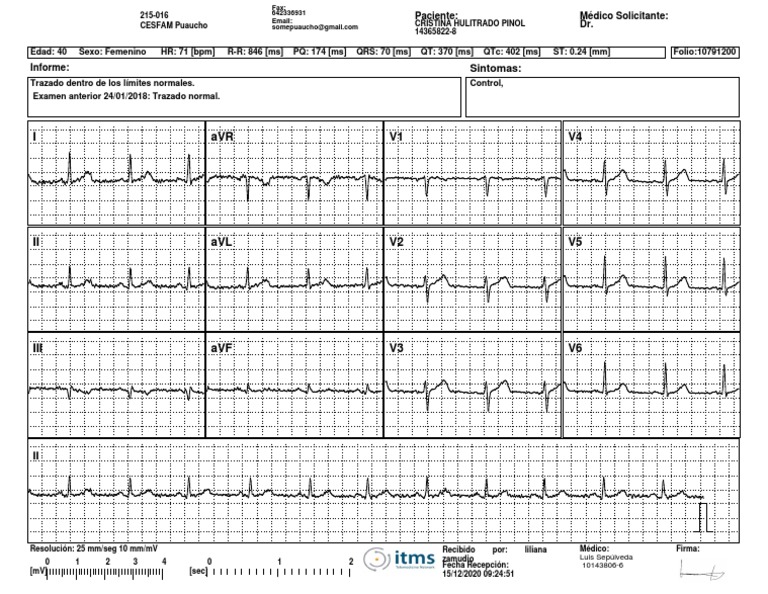 Informe ECG | PDF