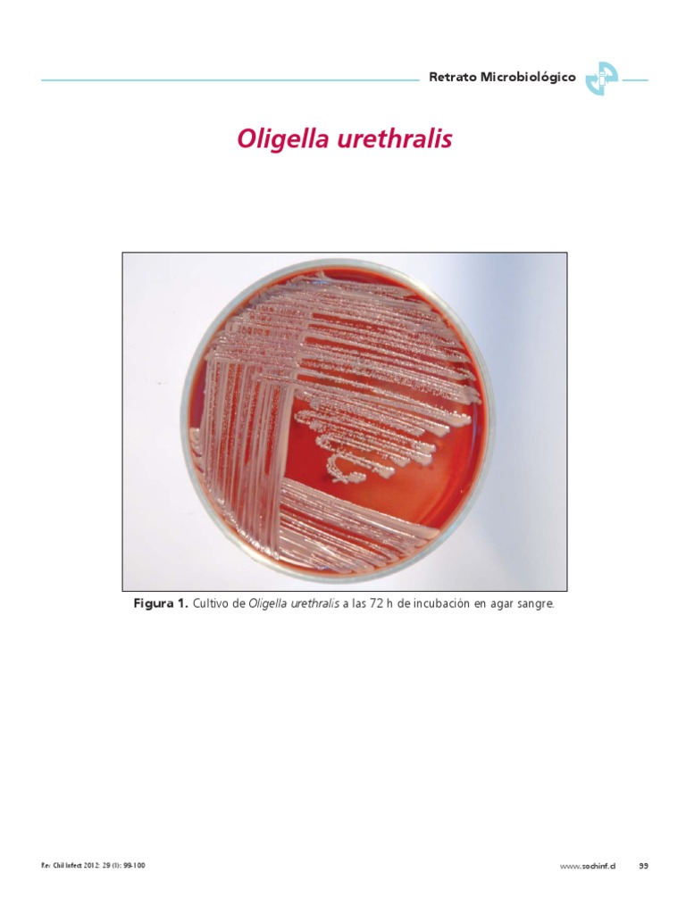 Oligella Urethralis | PDF | Patologia clinica | Microbiología