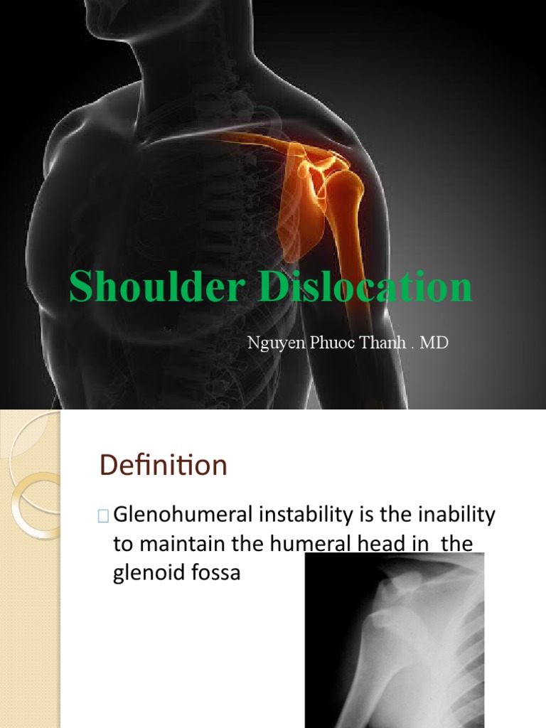 Shoulder Dislocation: Nguyen Phuoc Thanh - MD | PDF | Shoulder | Limbs ...