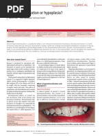 Monobond Plus - Instructions For Use | PDF | Water | Materials