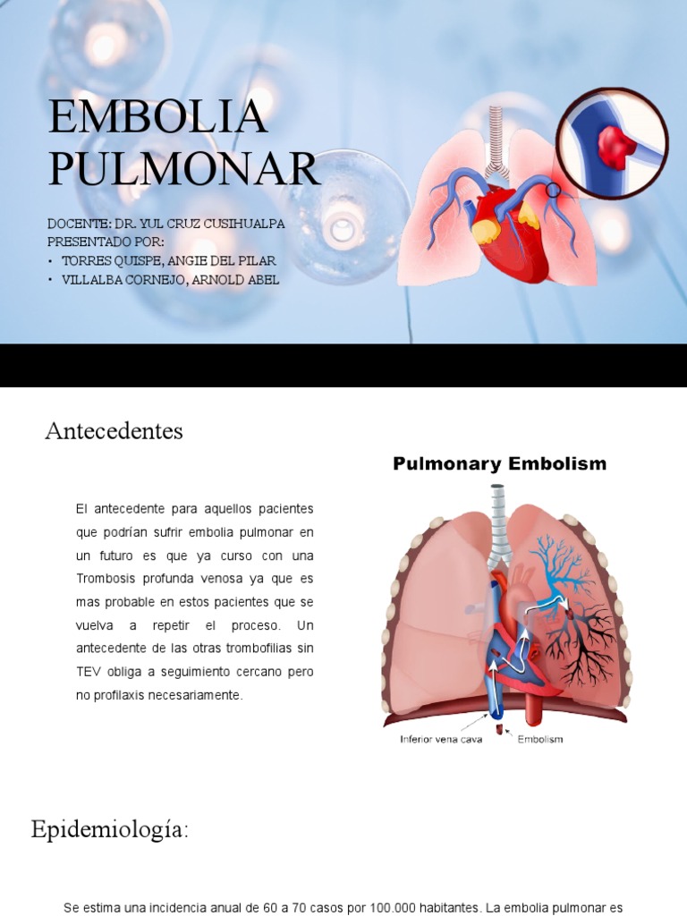 Embolia Pulmonar | PDF | Embolia | Trombo