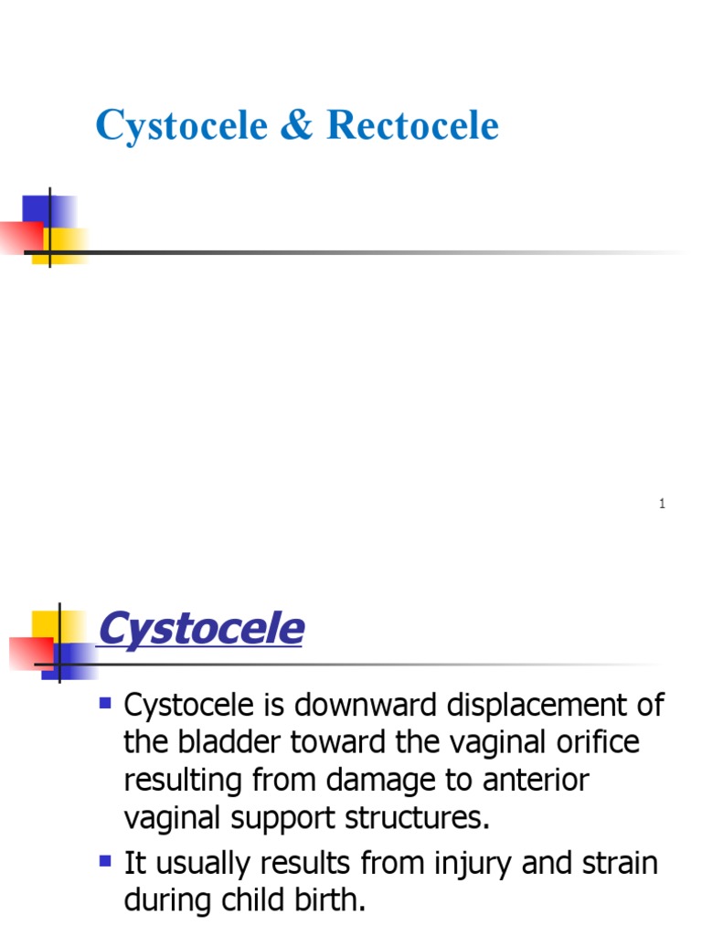 Cystocele & Rectocele | PDF | Vagina | Childbirth