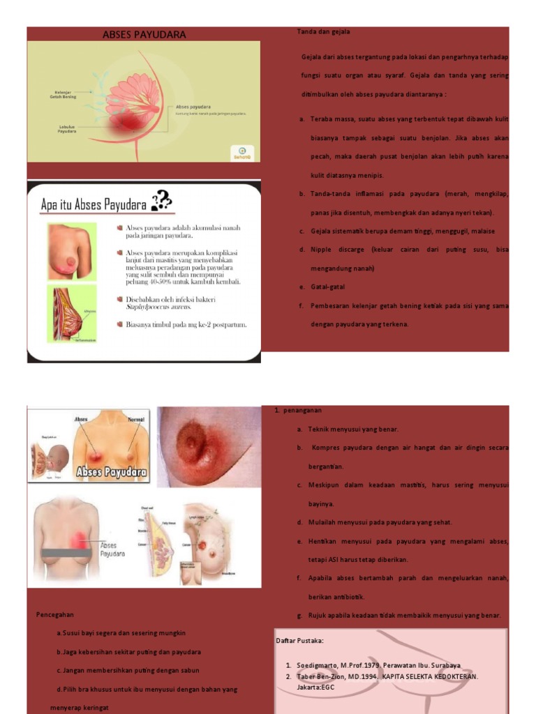 ABSES PAYUDARA - Nova | PDF
