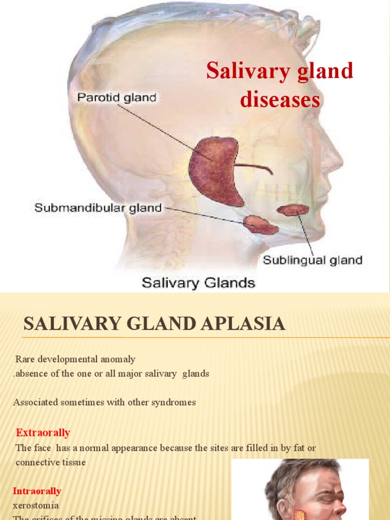 Salivary Gland | PDF | Diseases And Disorders | Gastroenterology