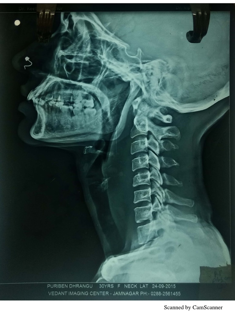 Ent Xray+specimen | PDF