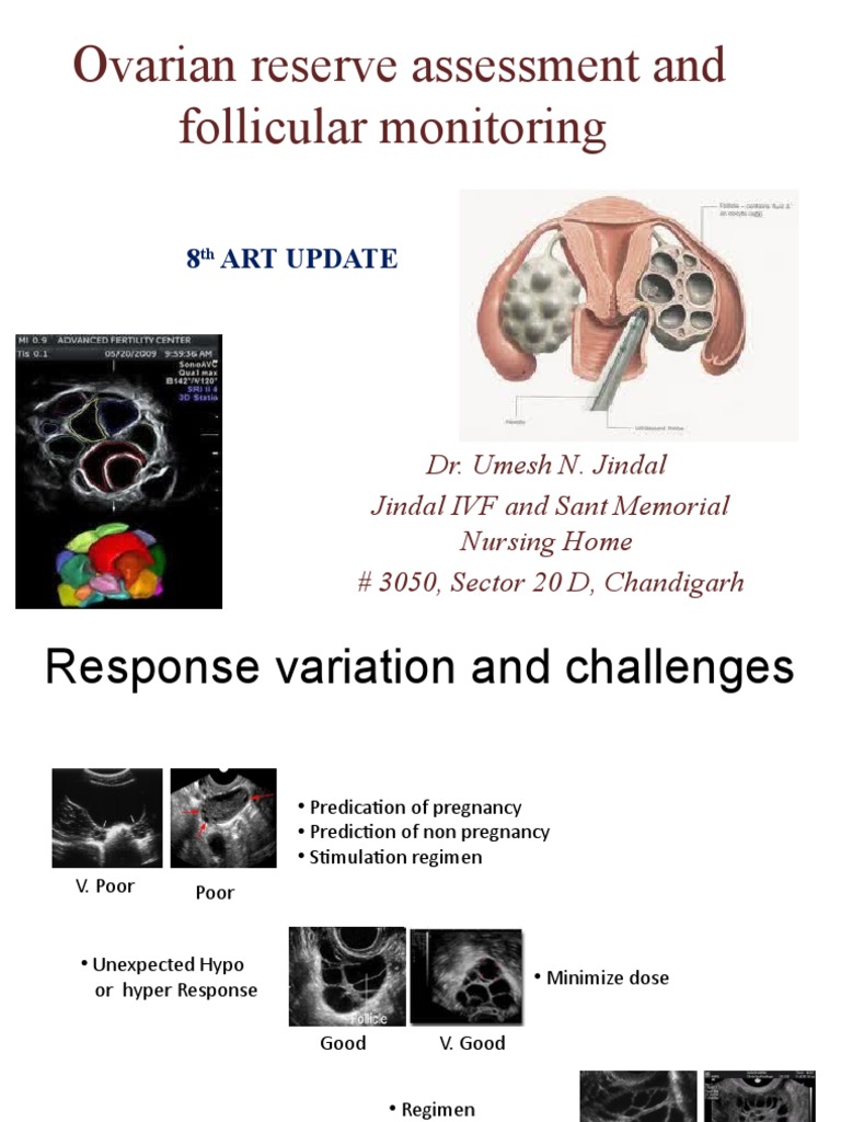 Ovarian Reserve Testing and Follicular Monitoring | PDF | Ovary ...