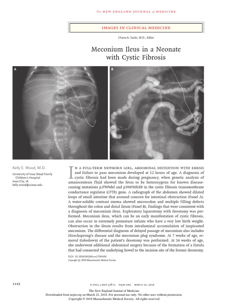 RX Ileus Meconial CF | Download Free PDF | Medicine | Gastroenterology