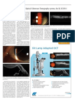 Sulcus IOL Power Adjustment Guide | PDF | Eye | Ophthalmology