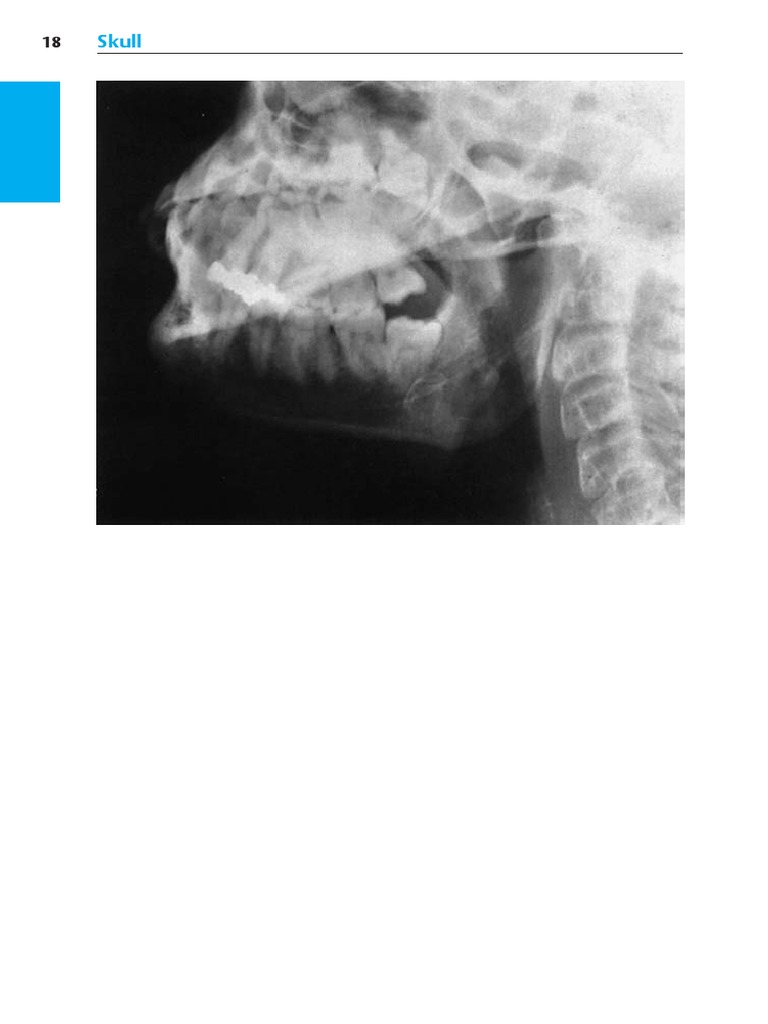 Pocket Atlas of Radiographic Anatomy 31-40 | PDF | Skull | Face