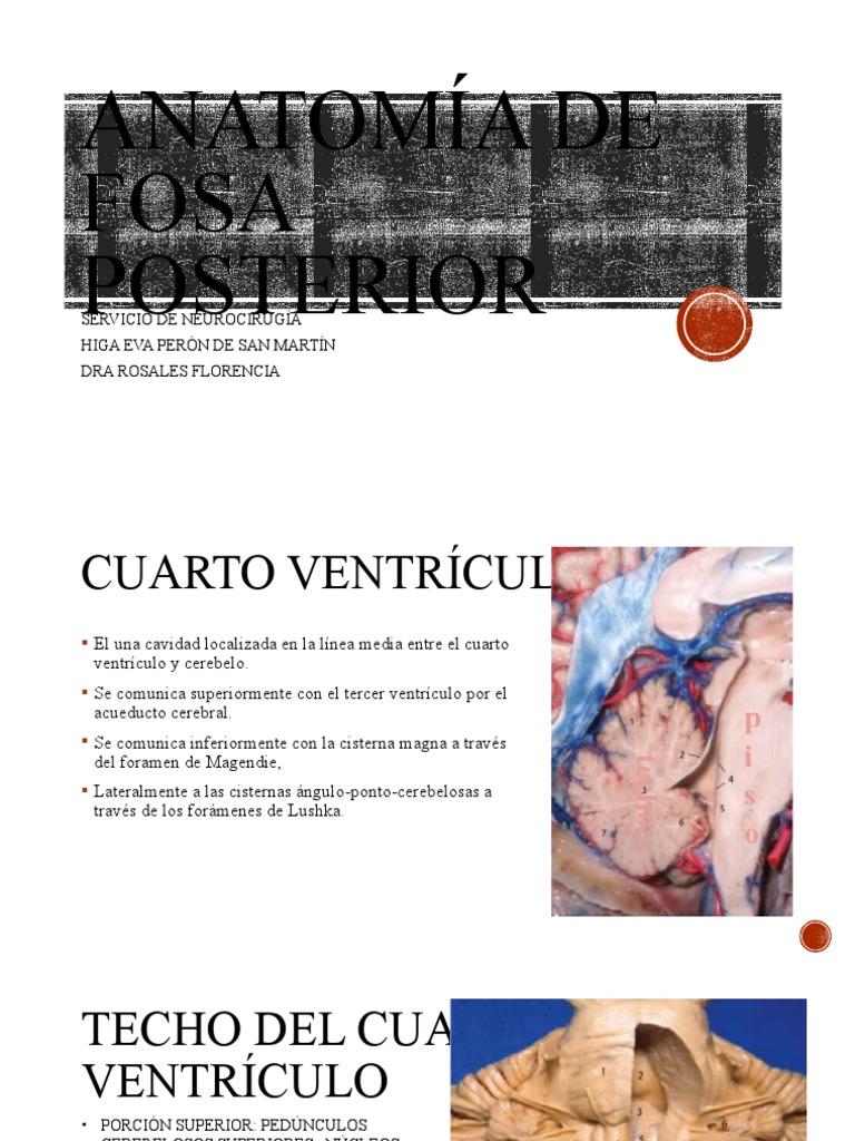 Anatomía de Fosa Posterior | PDF | Cerebelo | Cabeza y cuello humanos