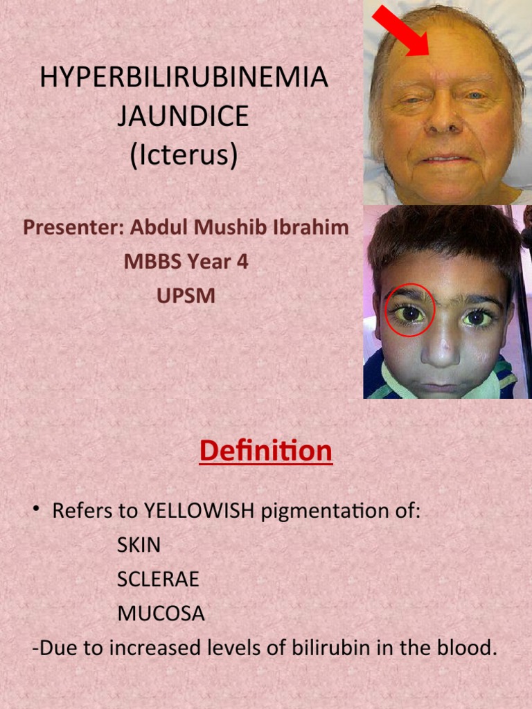 JAUNDICE Internal Medicine Presentation | PDF | Liver | Medical Specialties