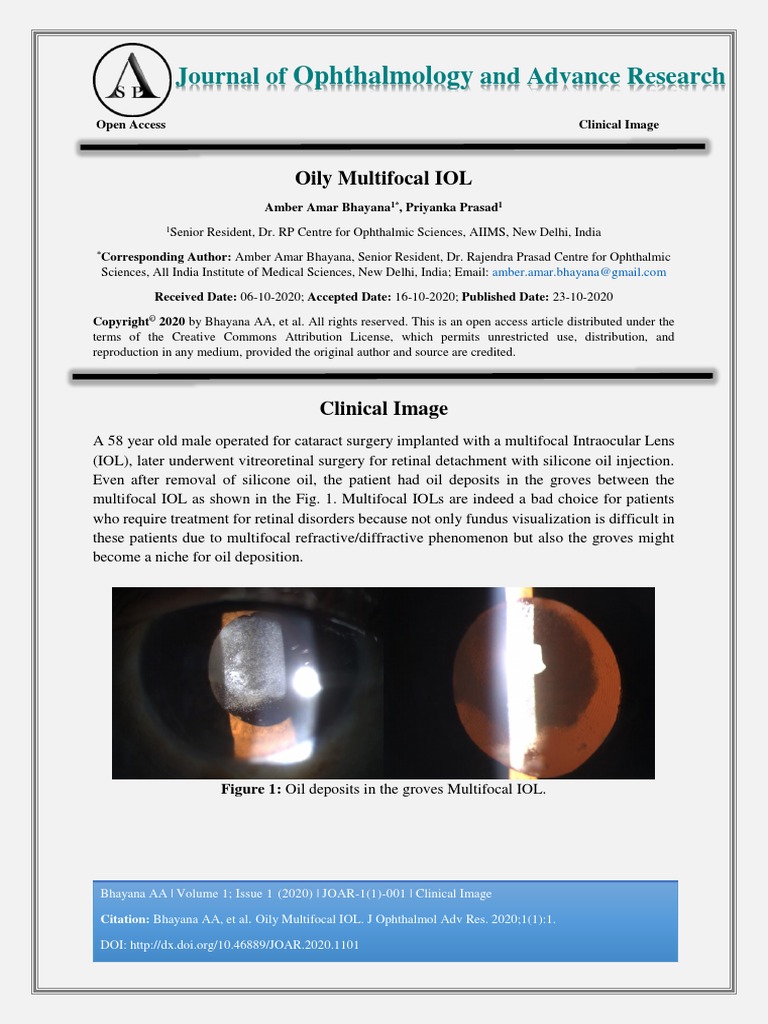 Oily Multifocal IOL | PDF