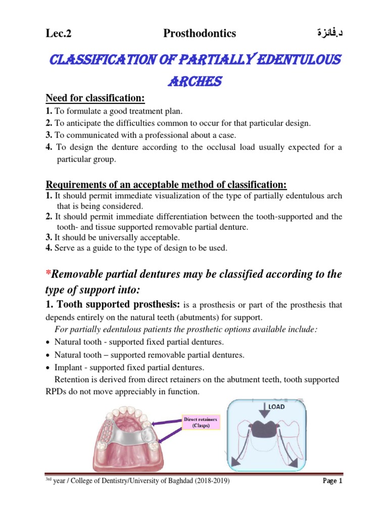 Classification of Partially Edentulous Arches: Lec.2 Prosthodontics ...