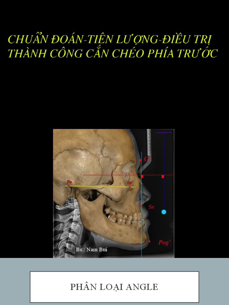 Chuẩn đoán phân biệt- điều trị cắn chéo phía trước | PDF