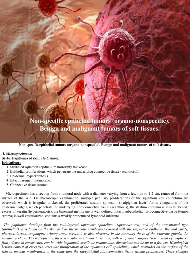 Non-Specific Epithelial Tumors (Organo-Nonspecific) - Benign and ...