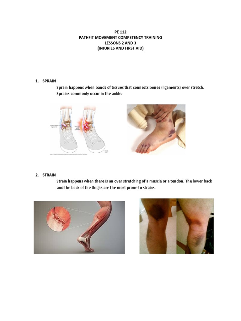 PE 112 Pathfit Movement Competency Training Lessons 2 and 3 (Injuries ...