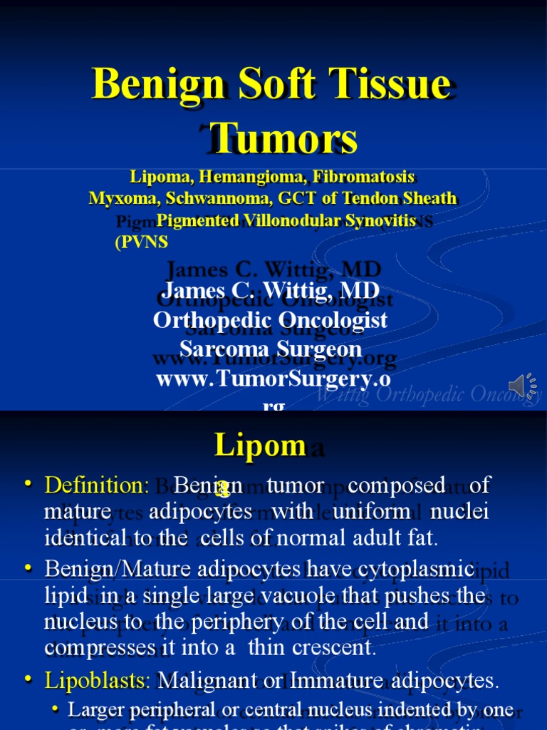 Overview of Benign Soft Tissue Tumors | PDF