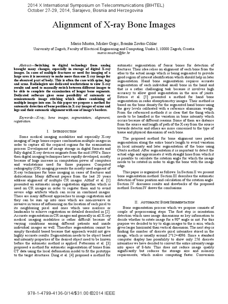Alignment of X-Ray Bone Images | PDF | Image Segmentation | Medical Imaging