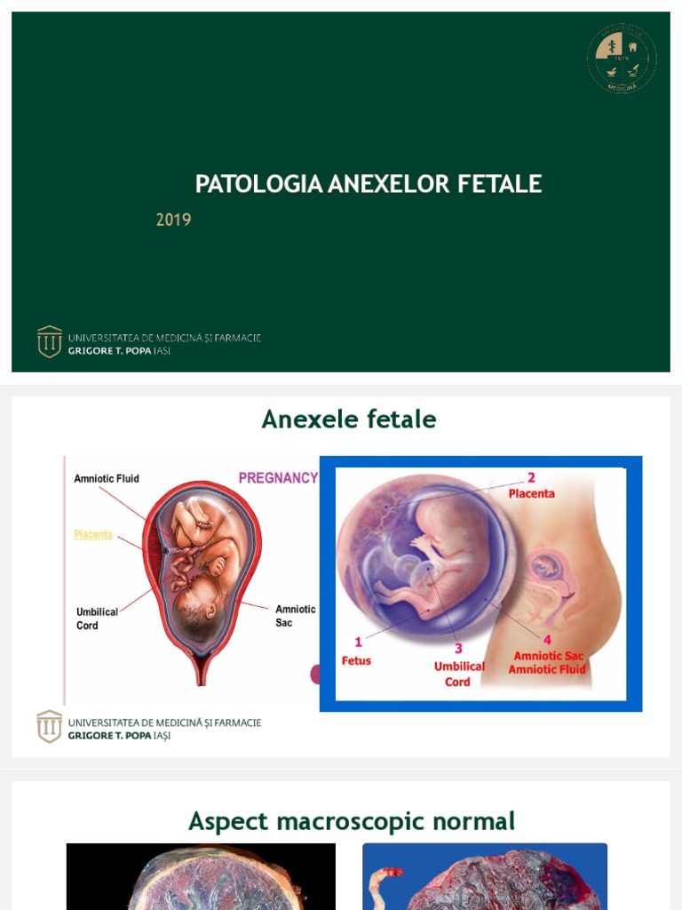 5.anexe Fetale Patologie | PDF