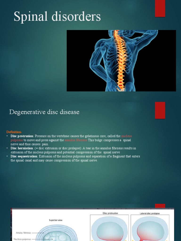Spinal Disorders | PDF | Medicine | Diseases And Disorders