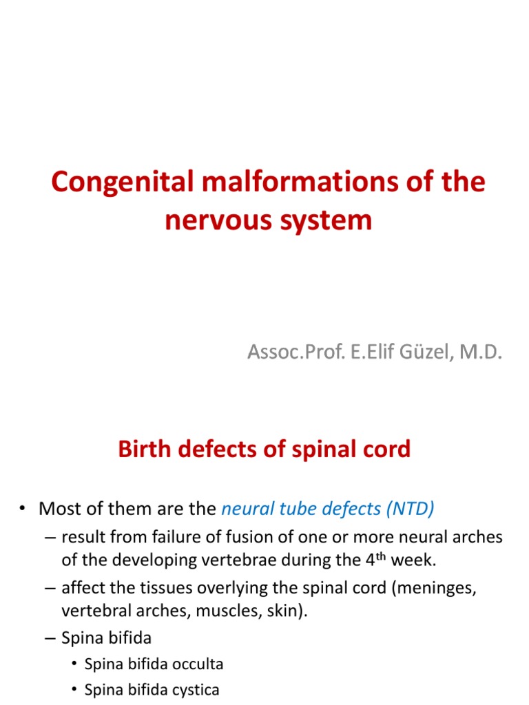 Congenital Malformations Of The Nervous System Pdf Pdf Vertebral