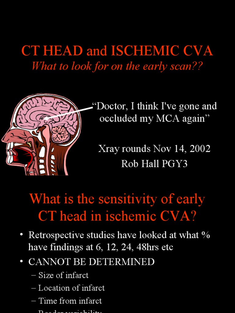 CT Head and Ischemic Cva: What To Look For On The Early Scan?? | PDF
