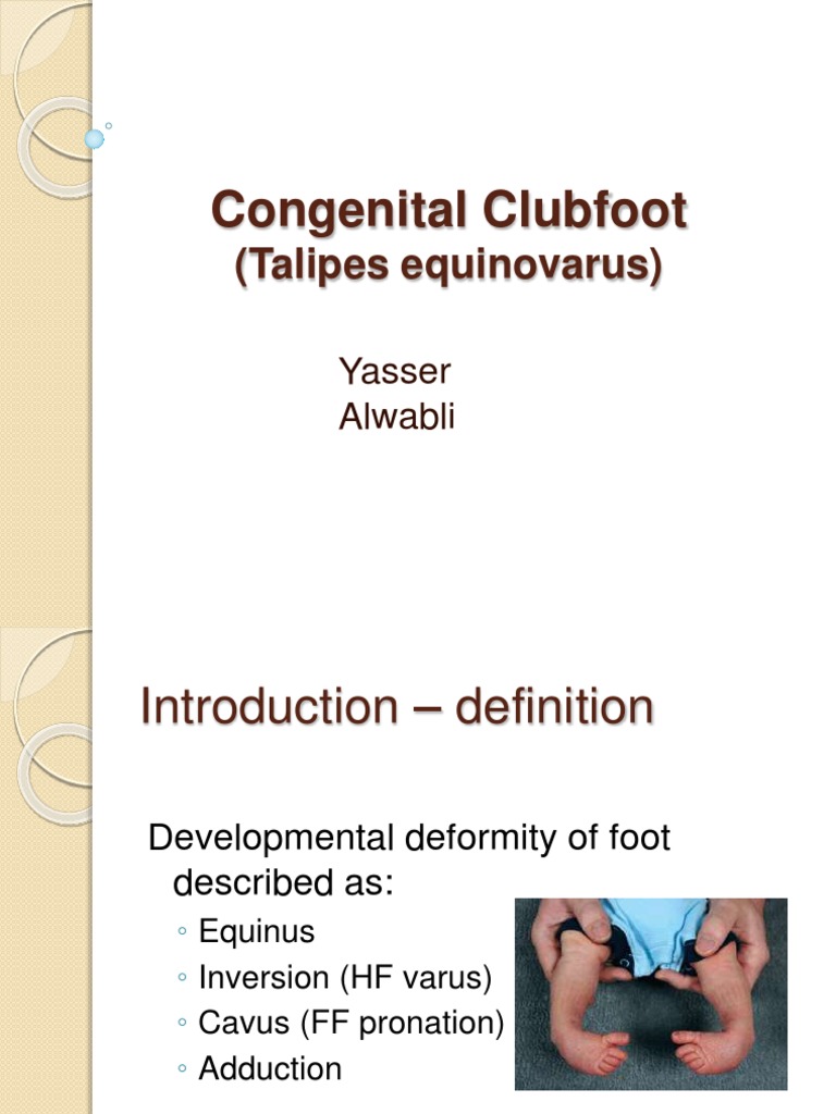 Congenital Clubfoot: (Talipes Equinovarus) | PDF | Foot ...