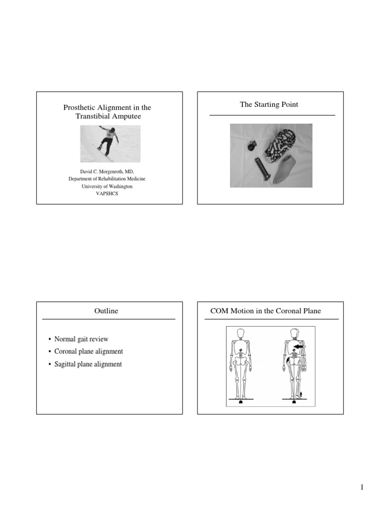 Prosthetic Alignment of TT | PDF | Anatomical Terms Of Motion | Prosthesis
