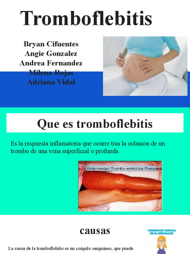 Tratamiento y causas de tromboflebitis | PDF | Trombo | Amamantamiento