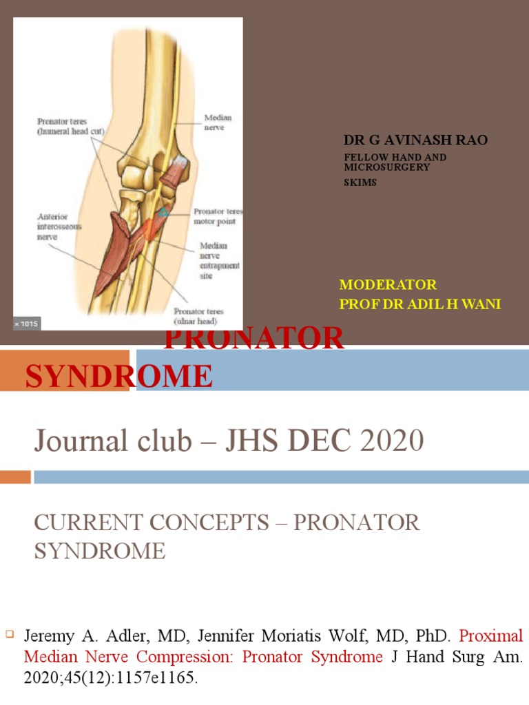 Pronator Syndrome | PDF | Carpal Tunnel Syndrome | Limbs (Anatomy)