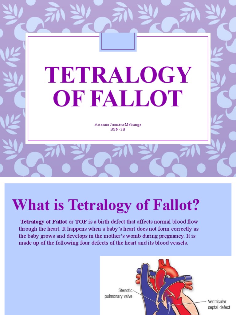 An In-Depth Exploration of Tetralogy of Fallot: Causes, Symptoms ...