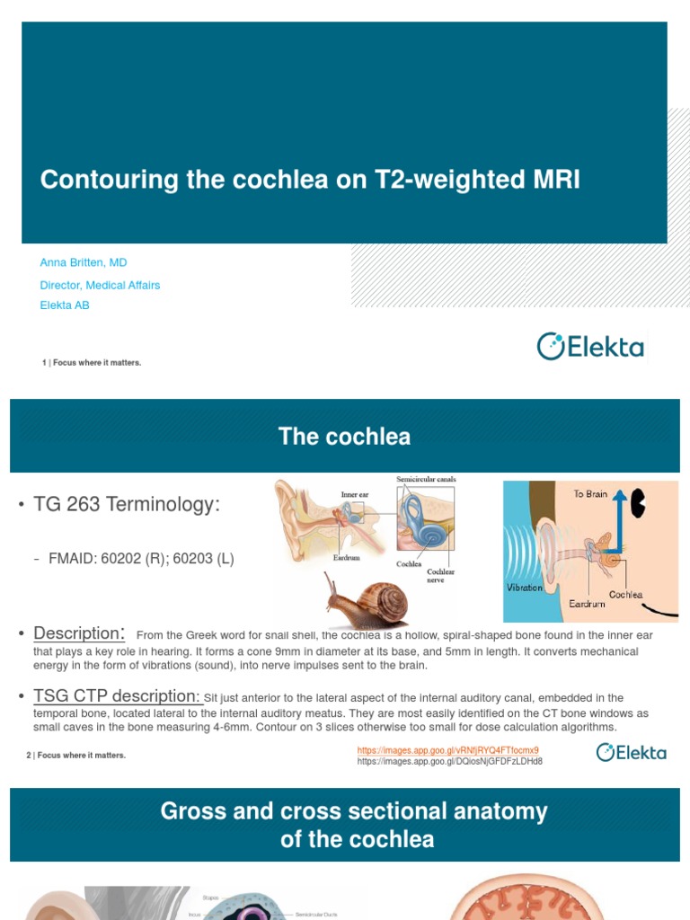 Contouring The Cochlea On T2-Weighted MRI: Anna Britten, MD Director ...
