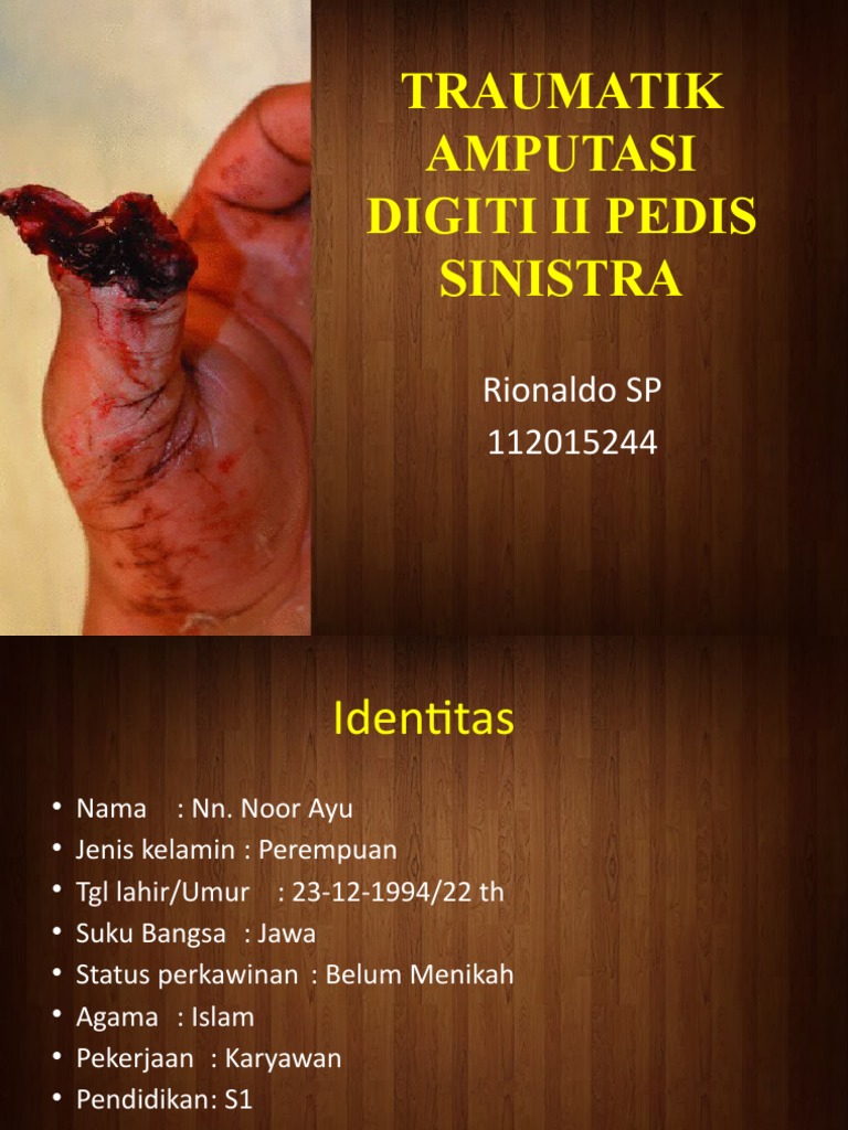 Traumatik Amputasi Digiti II Pedis Sinistra | PDF | Kesehatan Holistik