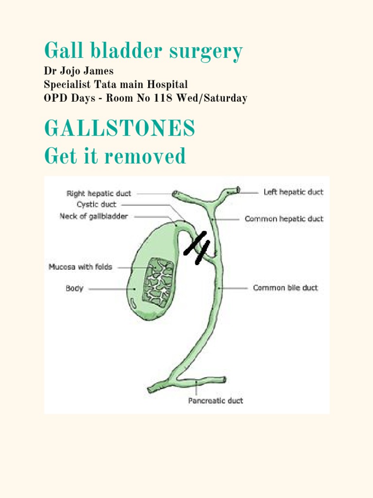Gall Bladder Surgery: DR Jojo James Specialist Tata Main Hospital OPD ...