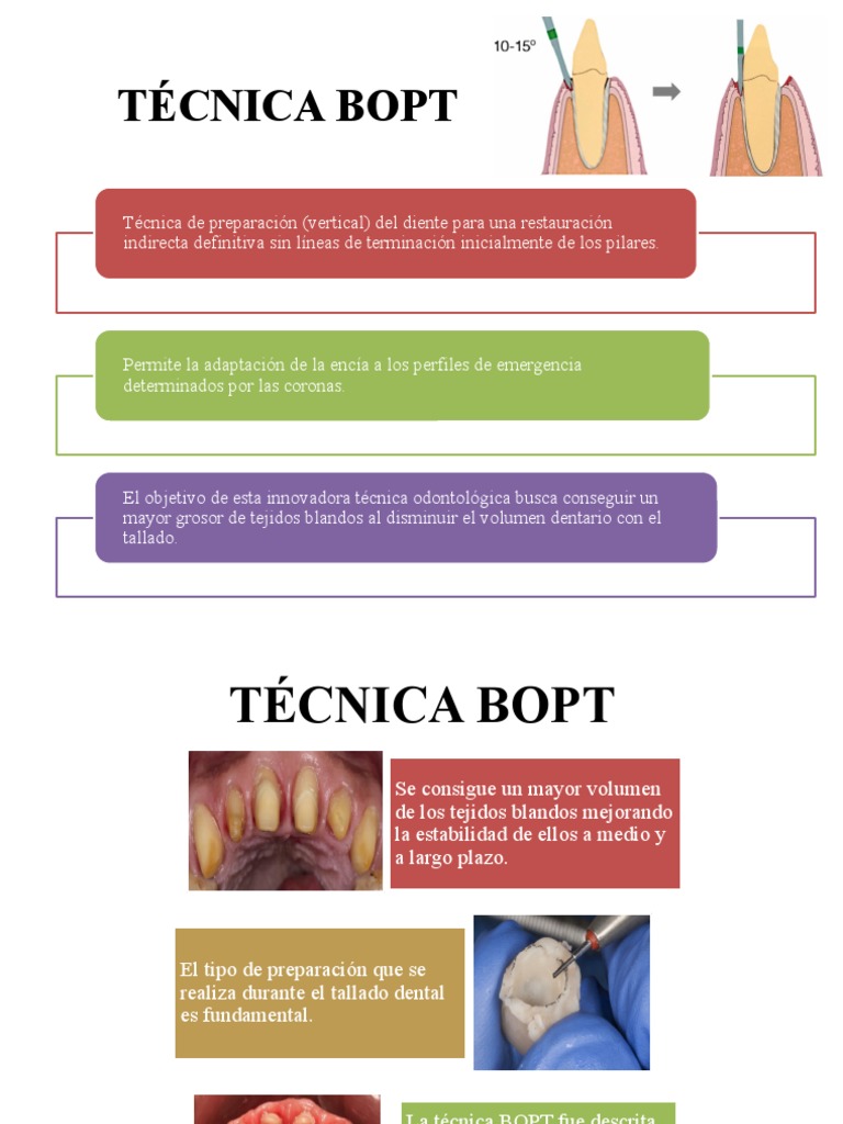 Técnica Bopt | PDF | Dentadura postiza | Boca