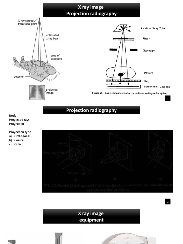 CT Index and Tomography | PDF