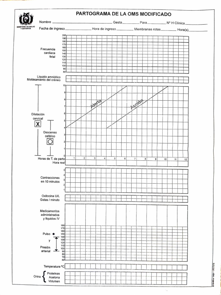 Partograma Oms Modificado | PDF
