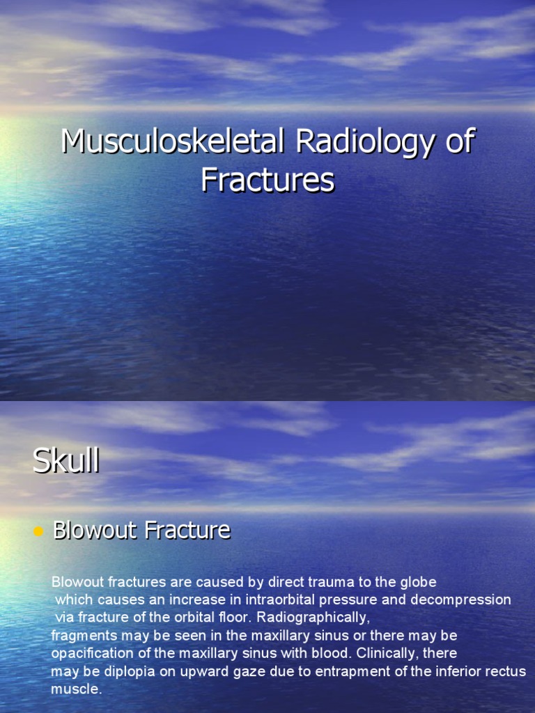 Bone Fractures - Radiology | PDF | Vertebra | Vertebral Column