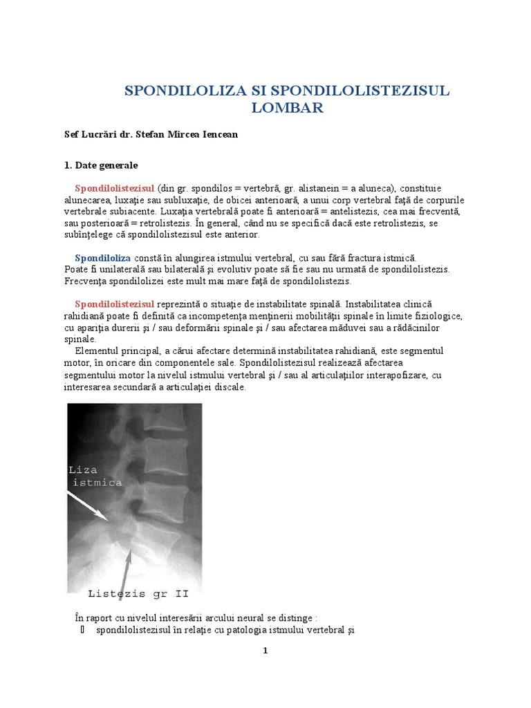 Spondiloliza Si Spondilolistezisul Lombar | PDF