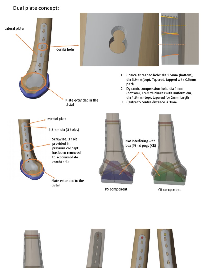 Dual Plate Design with Combi Hole | PDF | Sports & Recreation