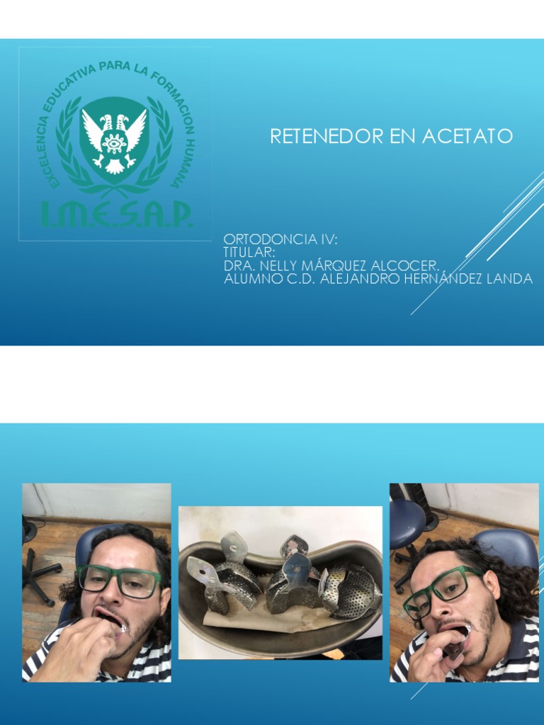 Retenedor Acetato PDF | PDF