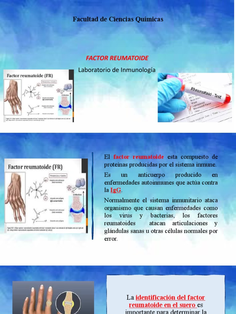 Factor Reumatoide | PDF