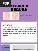 Puerperio Tardío | PDF | Parto | Periodo posparto