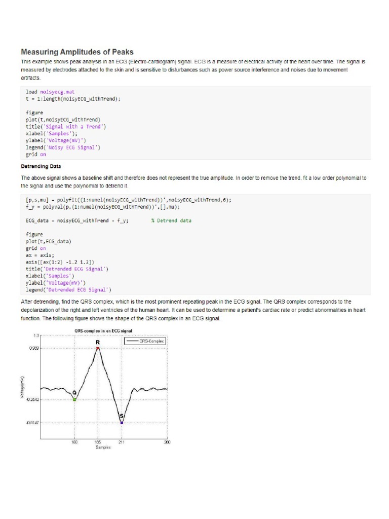 Detección Ondas QRS Matlab | PDF