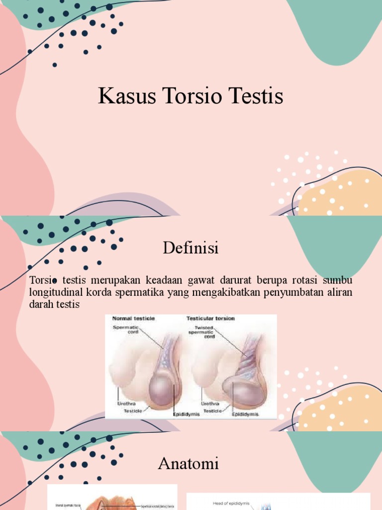 Torsio Testis | PDF