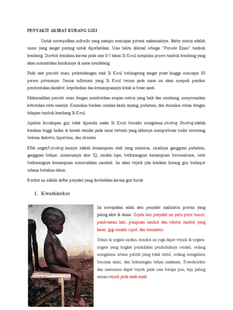 Penyakit Akibat Kurang Gizi | PDF Penyakit Akibat Kurang Gizi | PDF