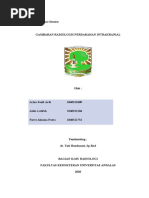 Perbedaan-Letak Lesi-Sdh-Edh-Ich-Ivh-Sah | PDF