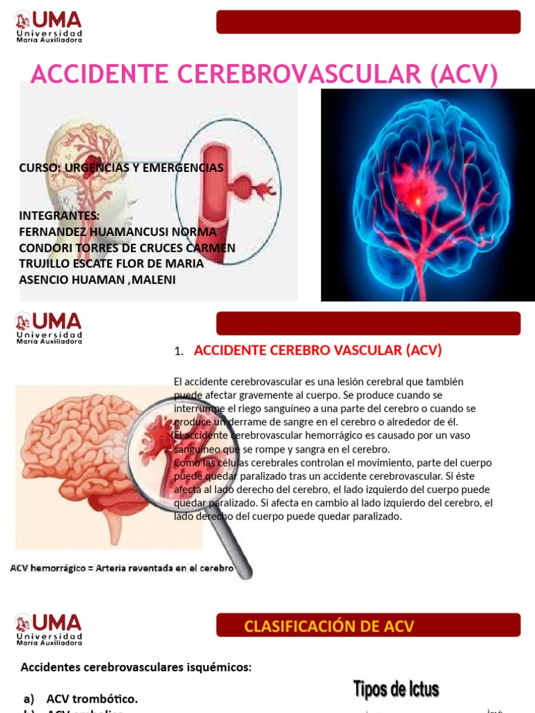 Expos. Caso Clinico Acv (DCV) | PDF | Carrera | Nutrición