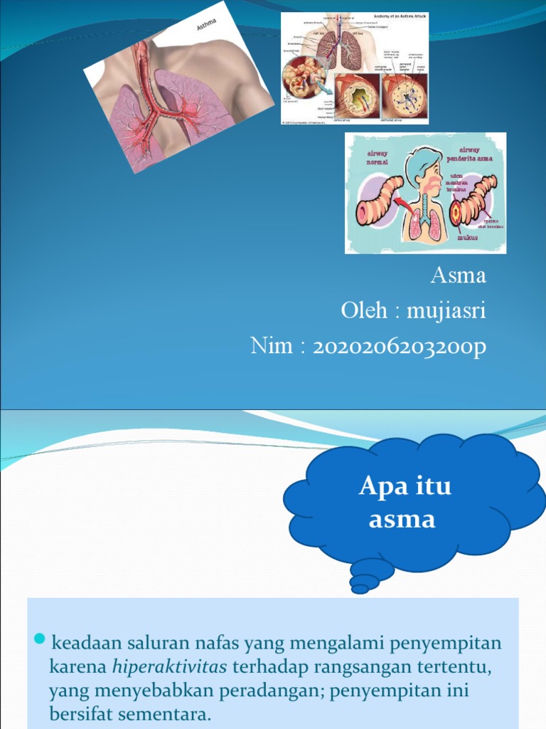 Asma | PDF